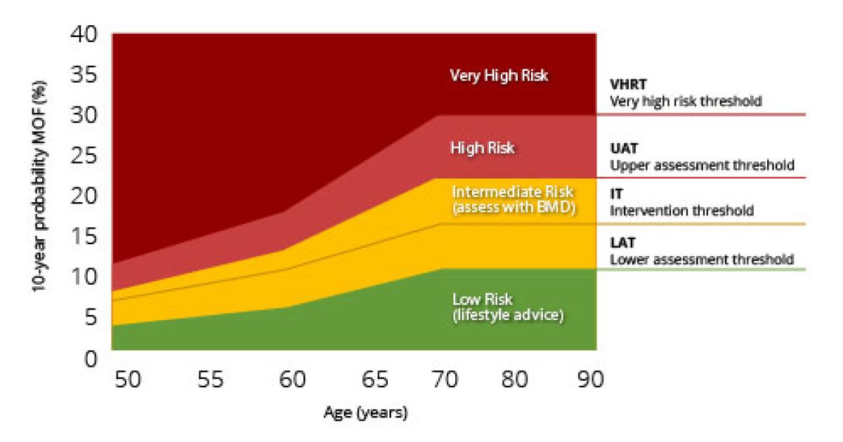 UK National Osteoporosis Guideline Group publishes new guidance ...